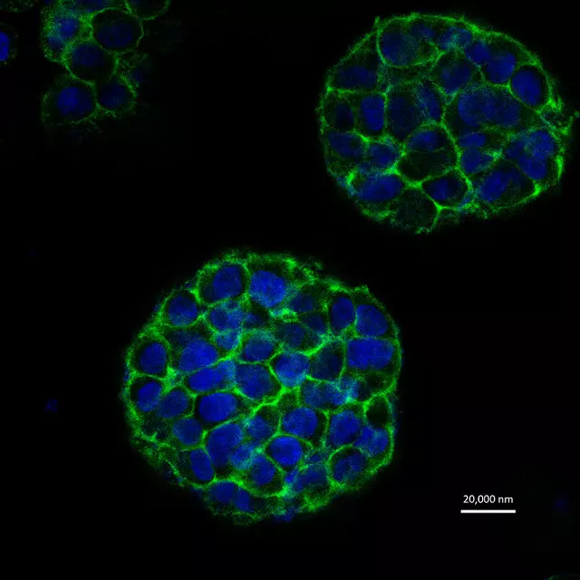 Paano makakapag-print ng 3D sa paggamot ng kanser? FACEPLA.NET Pinakabagong Ecology News.