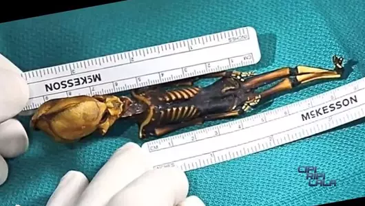Un squelette extraterrestre est un mystère médical