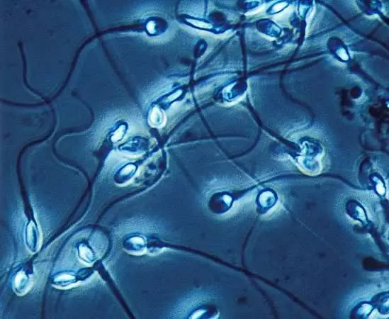 The content of spermatozoa in French men fell by one third for 16 years