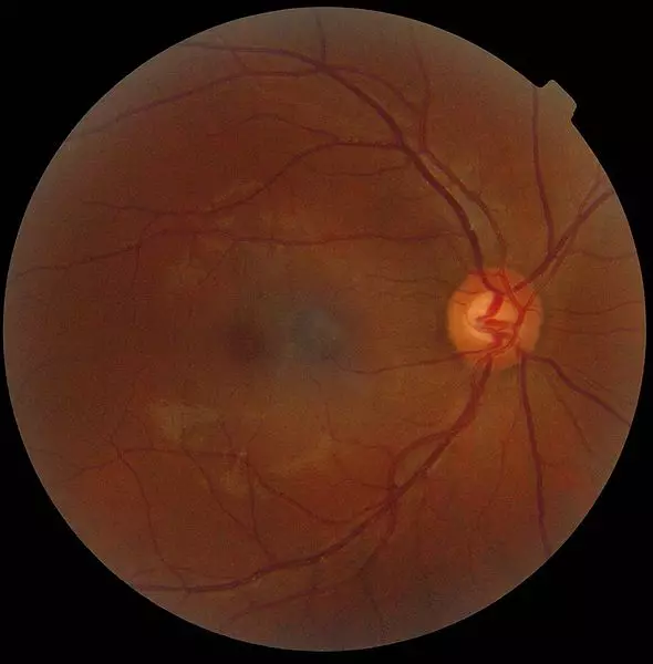 Наједноставното око и мал црн дроб се одгледуваат во лабораторијата